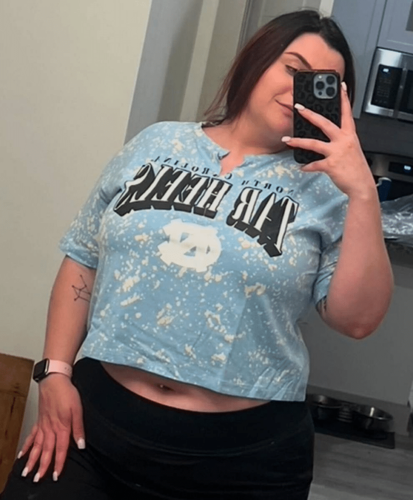 Before & After MedSpa Treatments in Spring, TX | Rae Anne